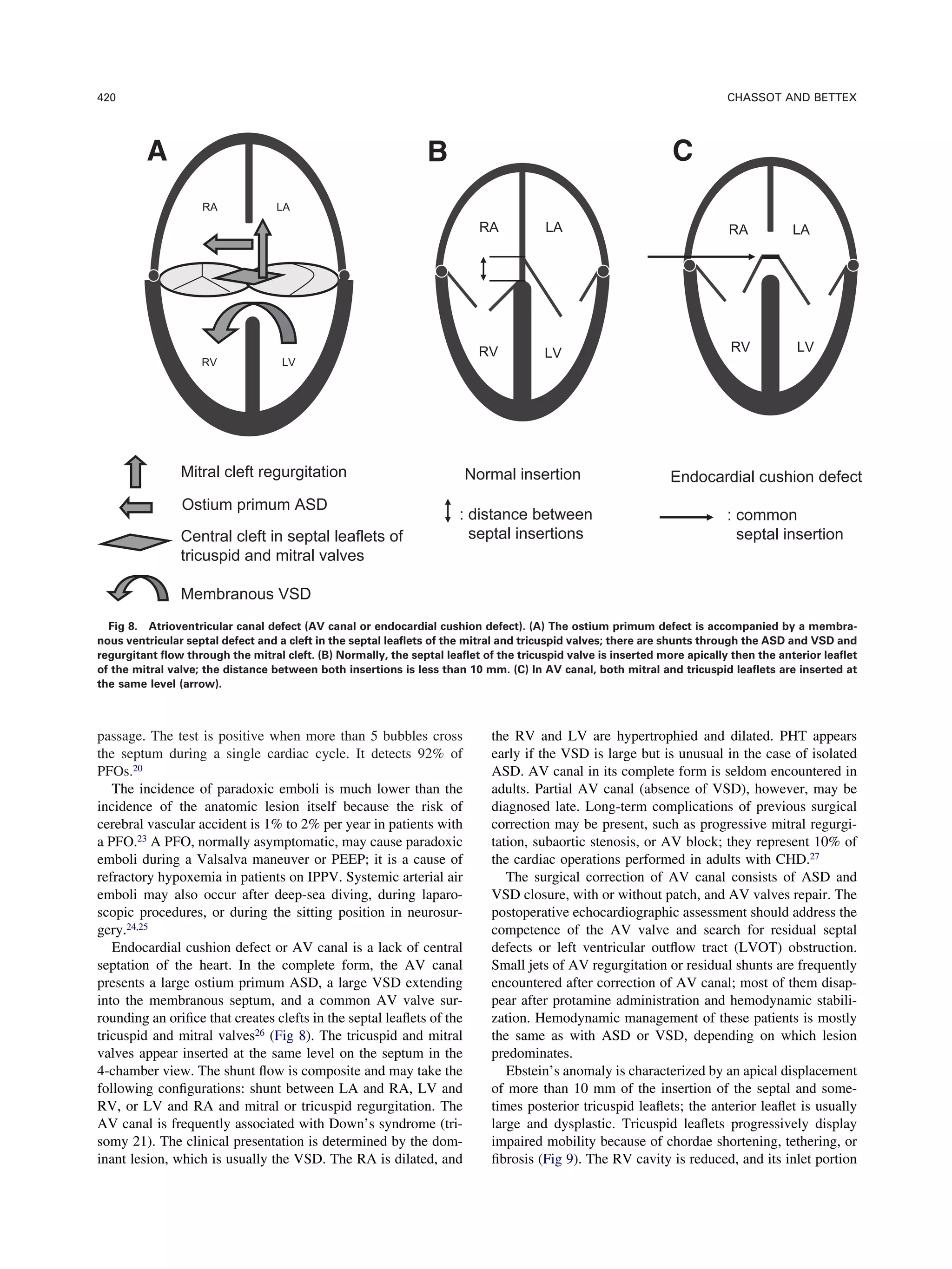 Anesthesia And Congenital Heart Disease | PDF