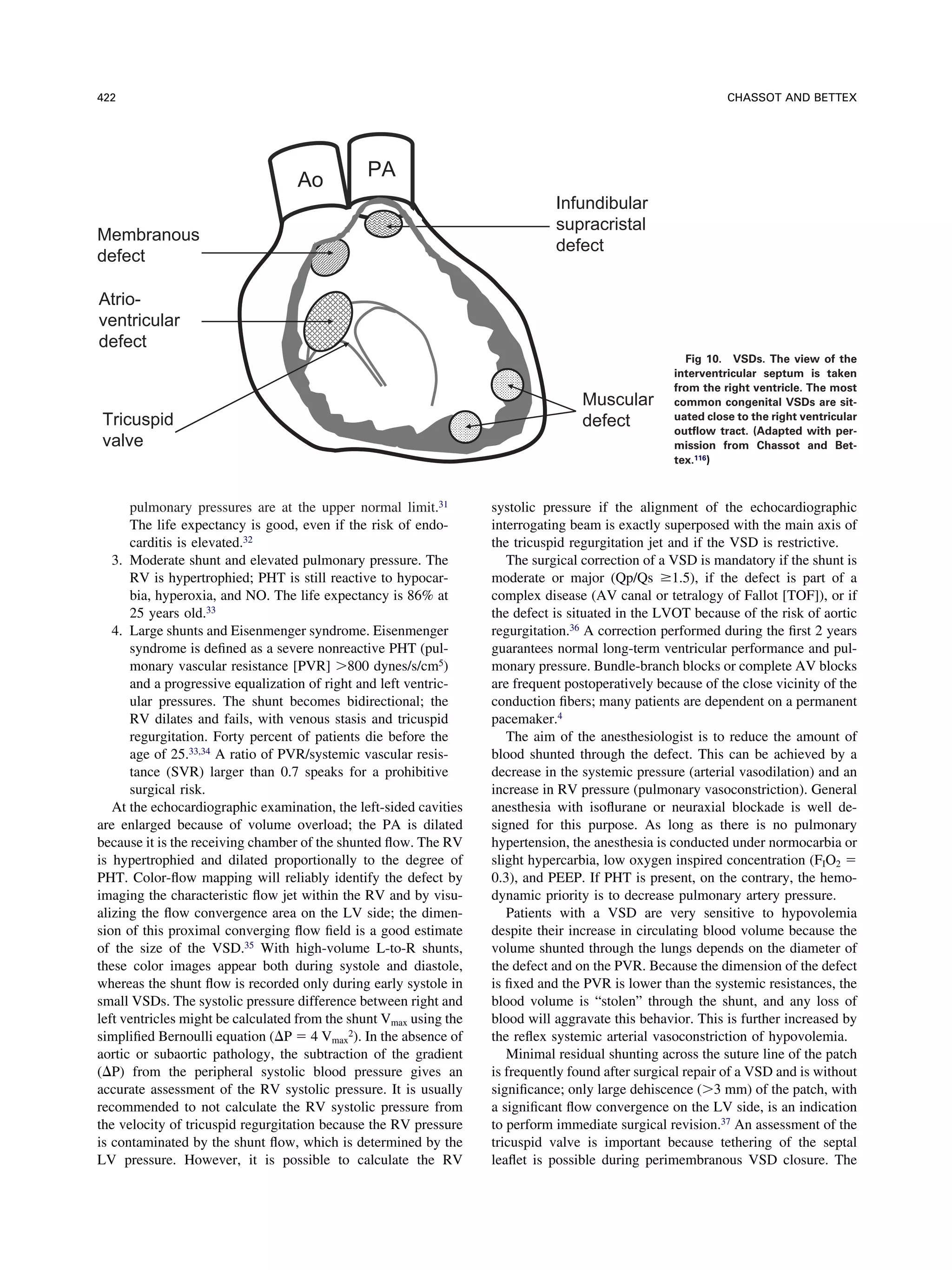 Anesthesia And Congenital Heart Disease | PDF