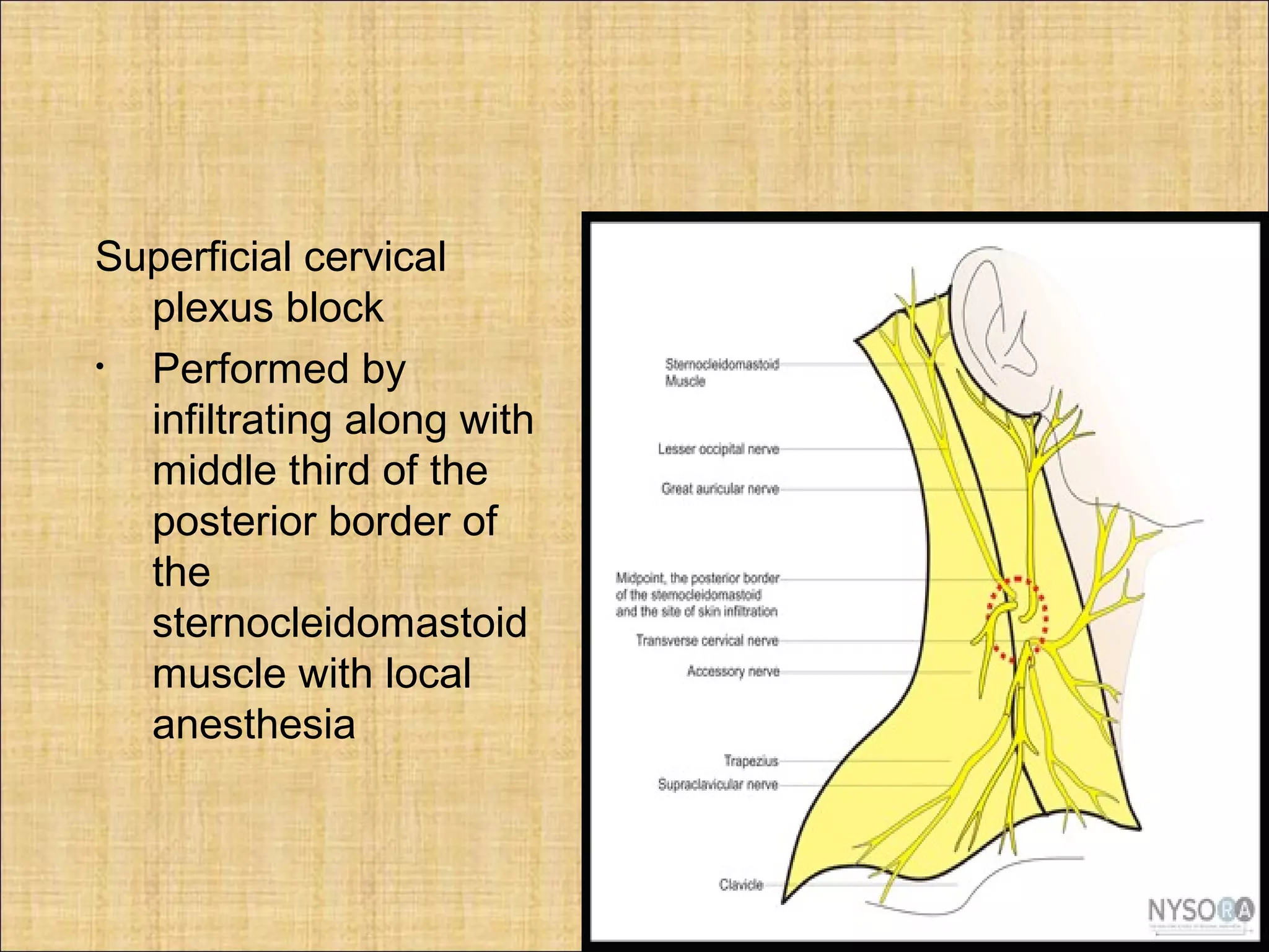 Anesthesia for-carotid-endarterectomy | PPT