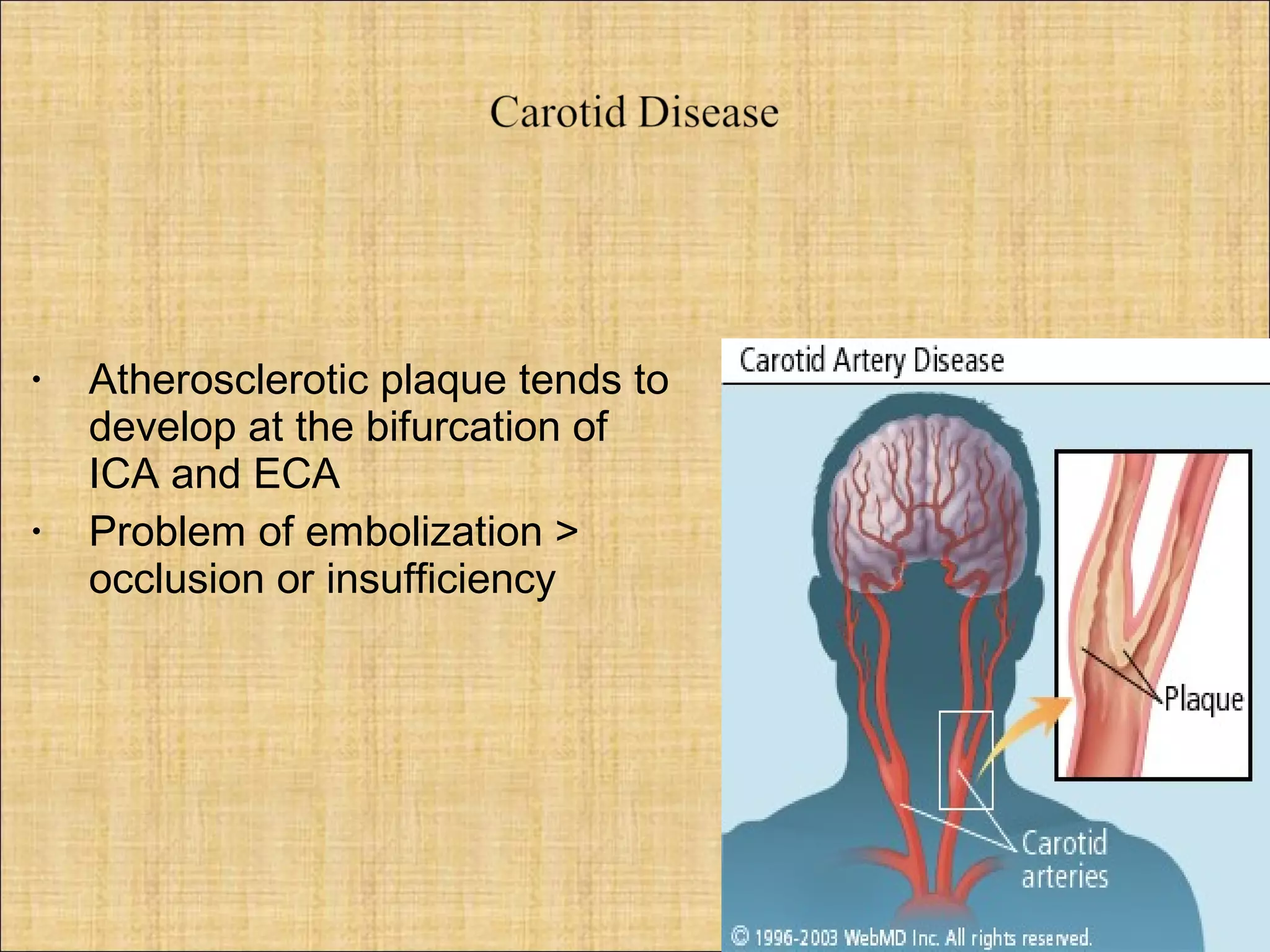 Anesthesia for-carotid-endarterectomy | PPT