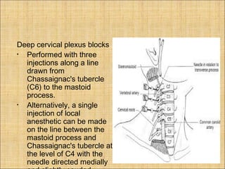 Anesthesia for-carotid-endarterectomy | PPT