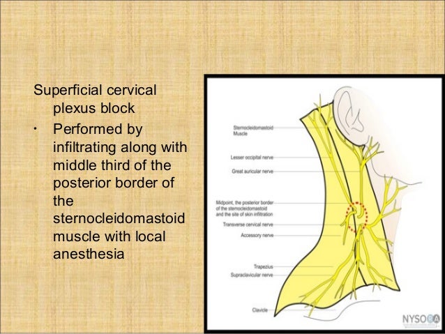 Anesthesia for-carotid-endarterectomy