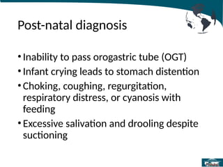 Anesthesia-for-Tracheoesophageal-Fistula-Repair | PPTX