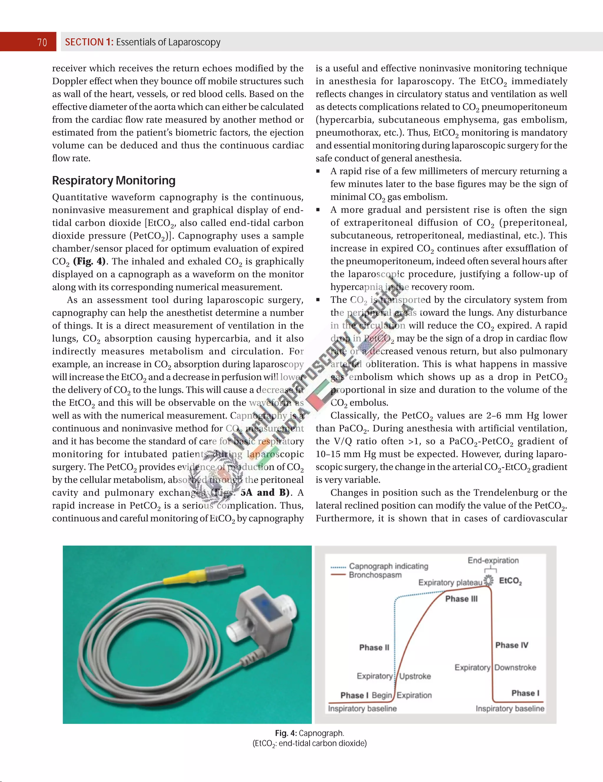 Anesthesia in Laparoscopic Surgery | PDF