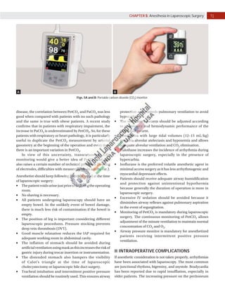 Anesthesia-in-Laparoscopic-Surgery (2).pdf
