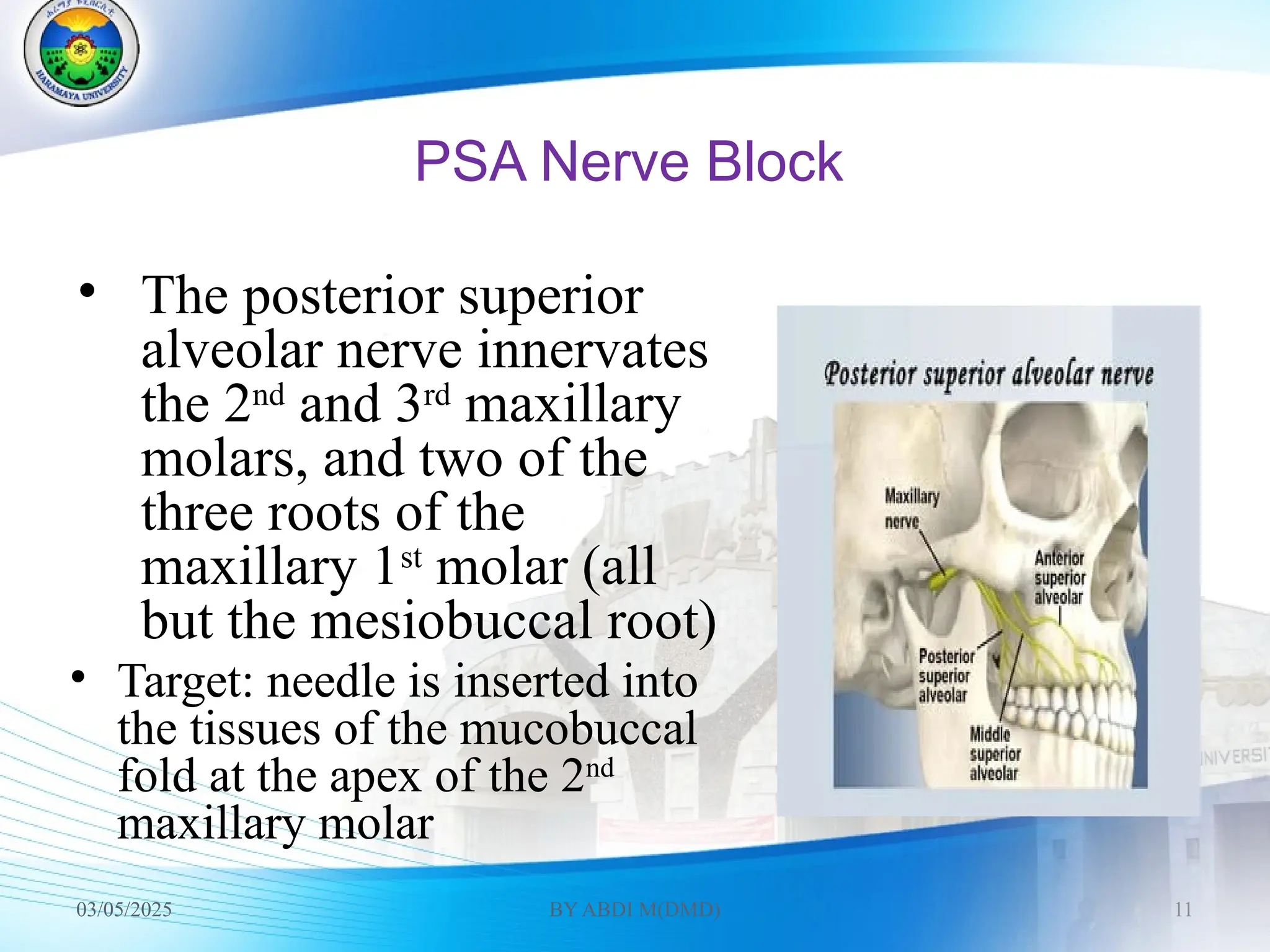 Anesthesia and EXOdontia dental ppt..... | PPTX