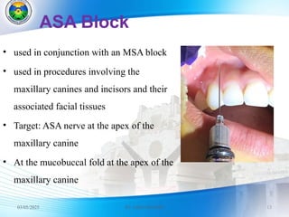 Anesthesia and EXOdontia dental ppt..... | PPTX