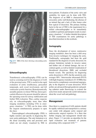 Anesthesia and perioperative care for aortic surgery | PDF
