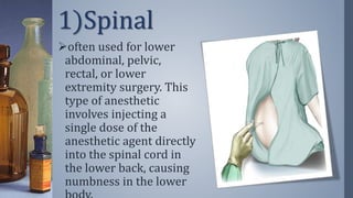 Anesthesia surgery.pptx