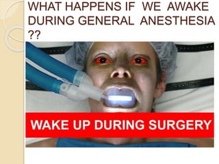 Anesthesia Awareness