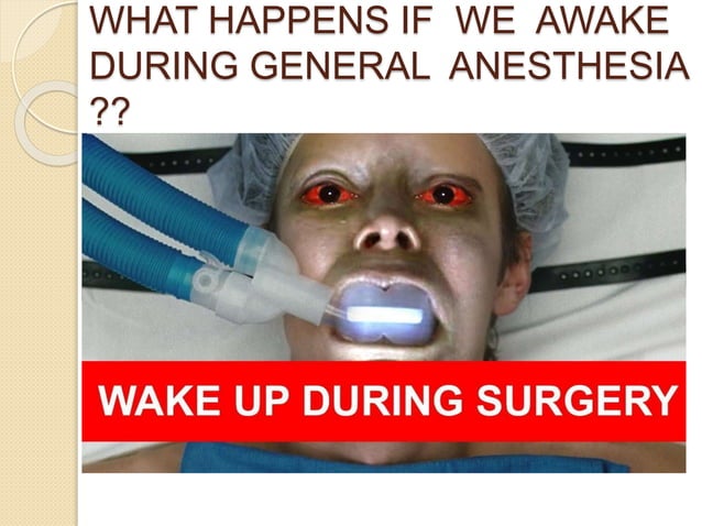 Anesthesia awareness | PPTX | Surgery | Medical Health