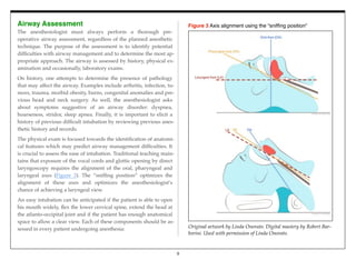 Anesthesia book pdf | PDF