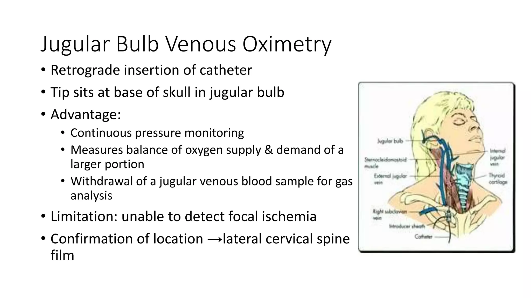 Anesthesia For Carotid Endarterectomy Pptx