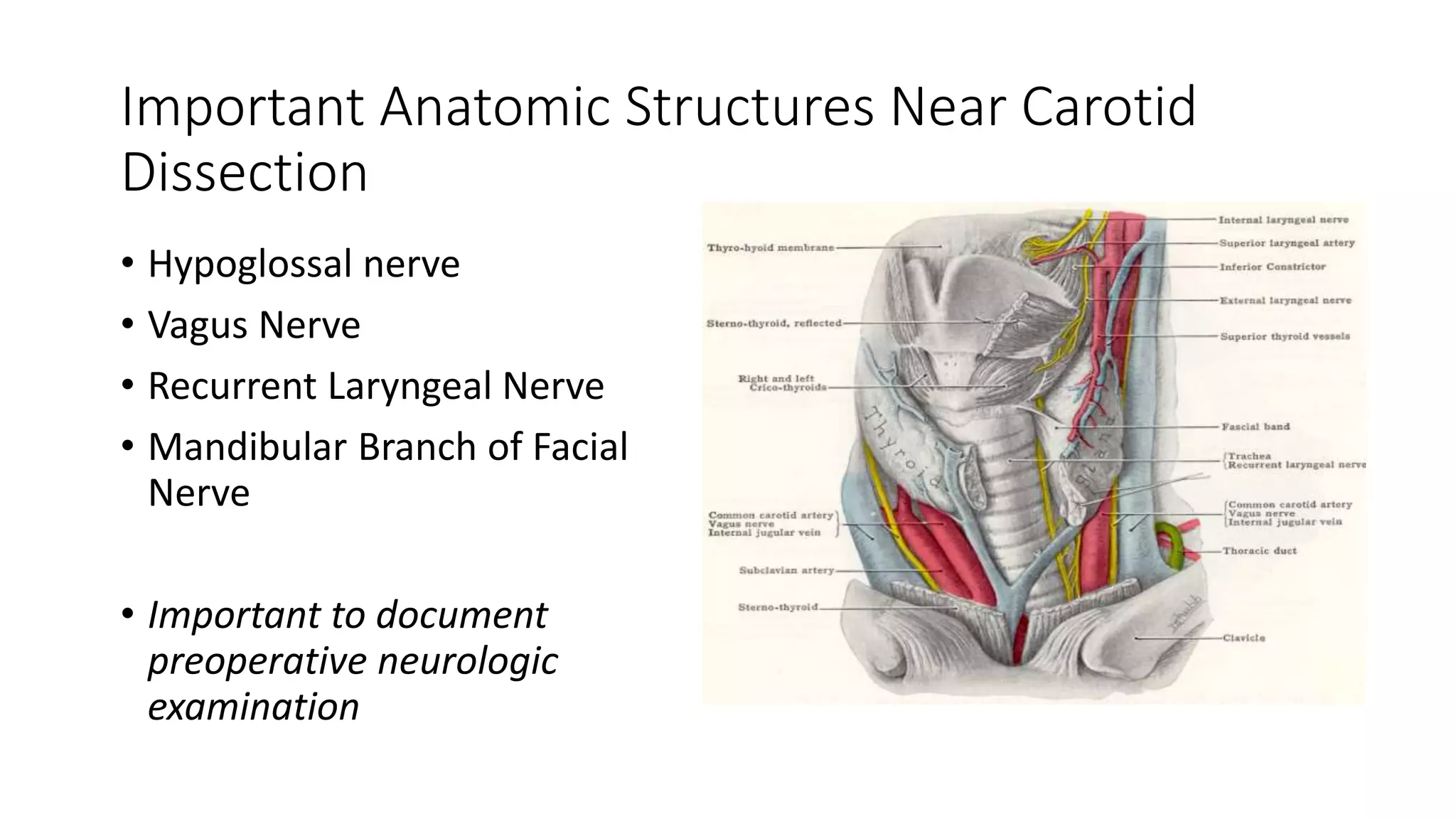Anesthesia for carotid endarterectomy | PPTX