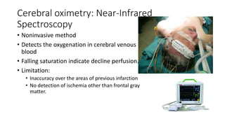 Anesthesia for carotid endarterectomy | PPTX