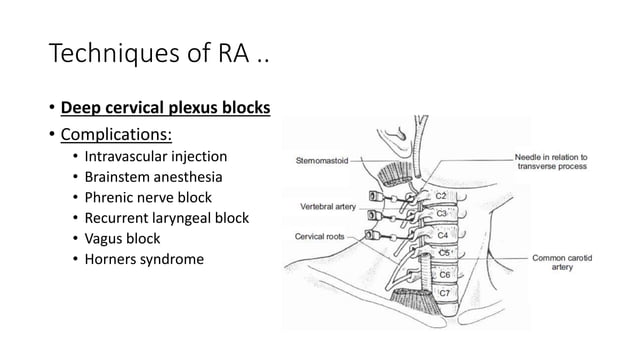 Anesthesia for carotid endarterectomy | PPTX