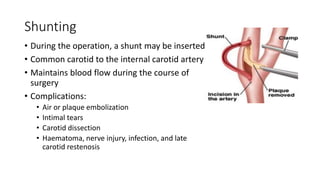 Anesthesia for carotid endarterectomy | PPTX