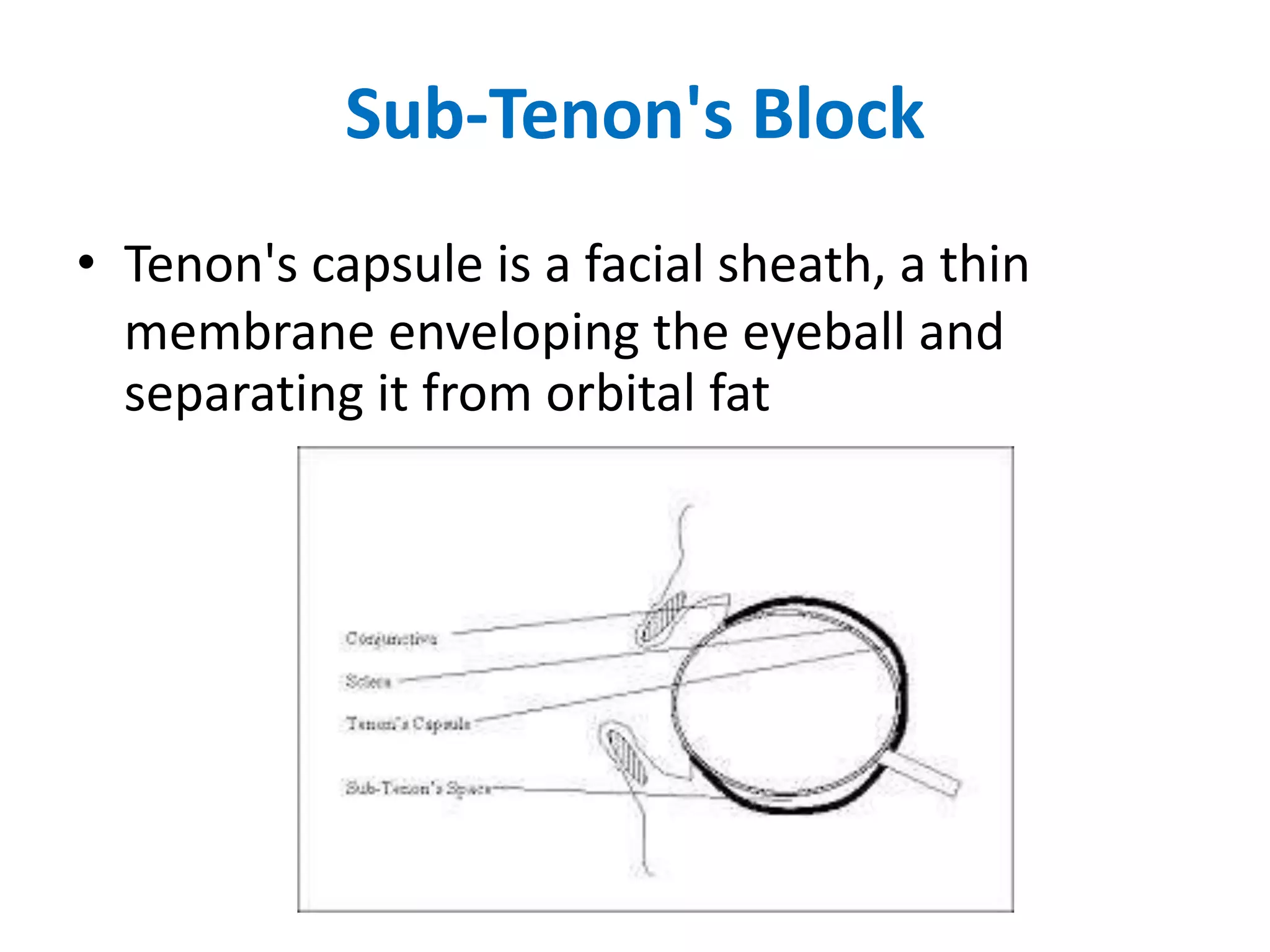 Anesthesia for cataract surgery | PPTX