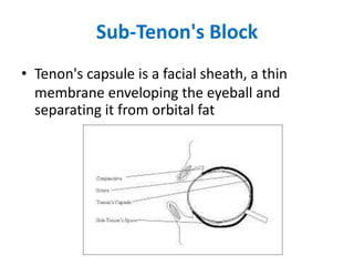 Anesthesia for cataract surgery | PPTX