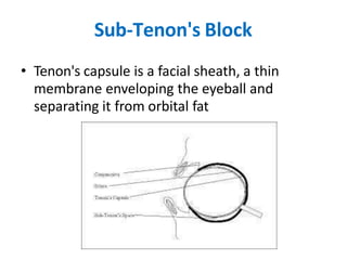 Anesthesia for Cataract Surgery DR PPS.pptx | Eye and Vision Conditions ...