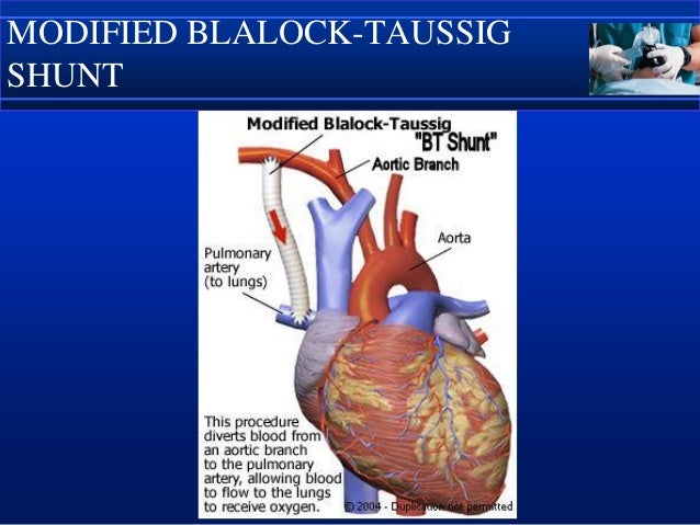 Anesthesia for children with Congenital Heart Disease