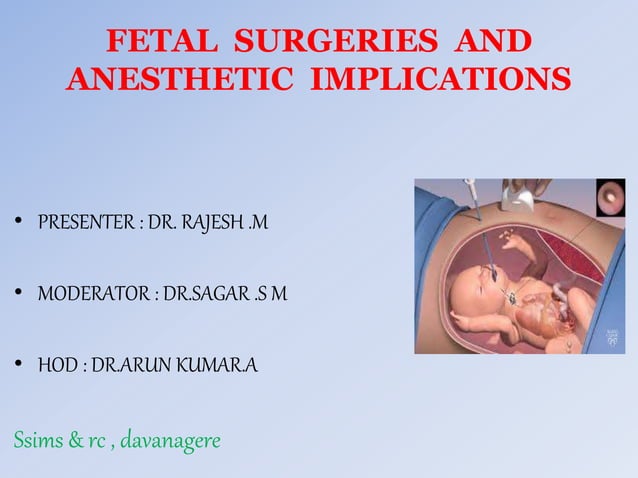 Anesthesia for fetal surgeries | PPT