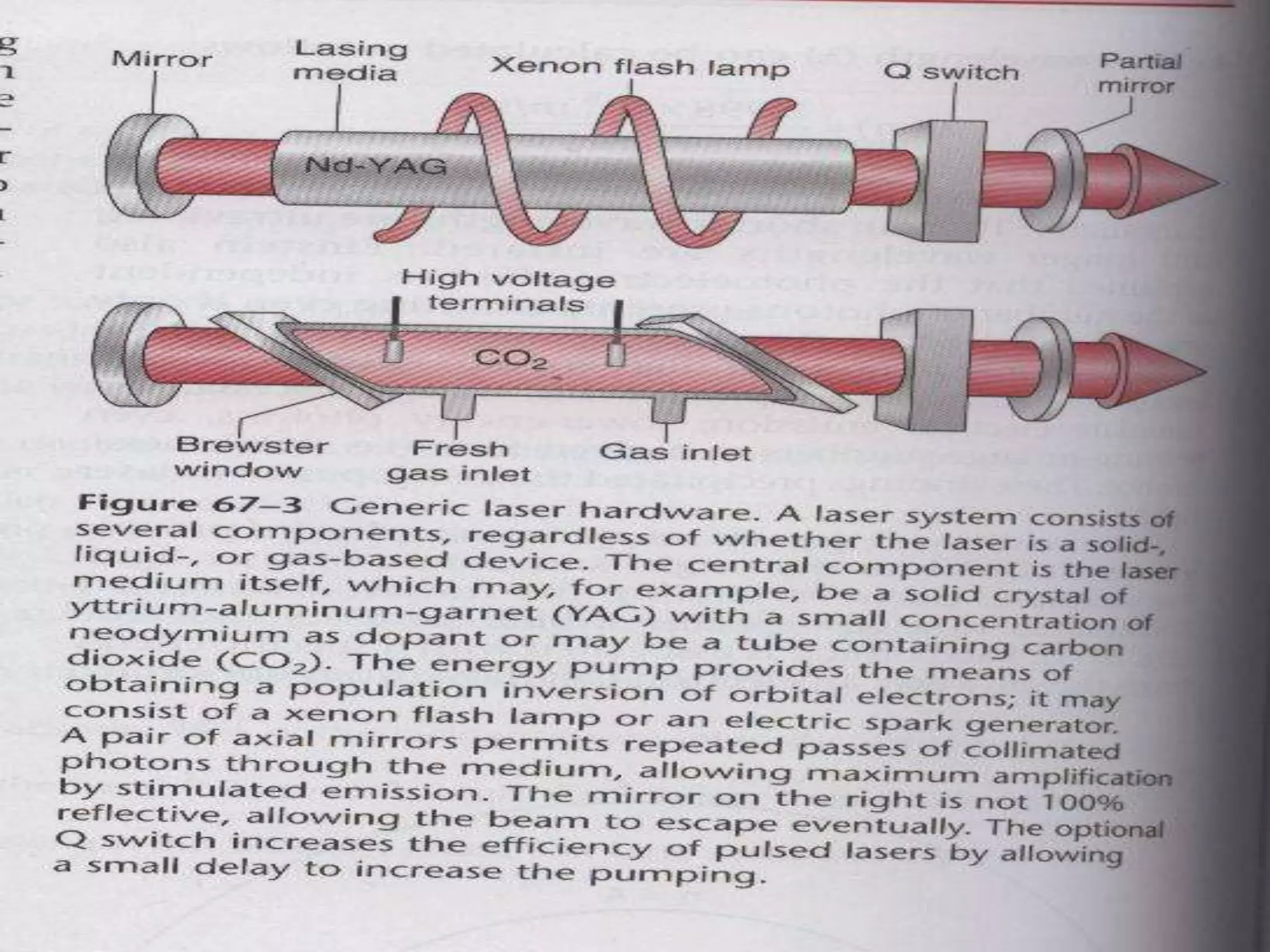 Anesthesia for laser surgery ranjith | PPTX