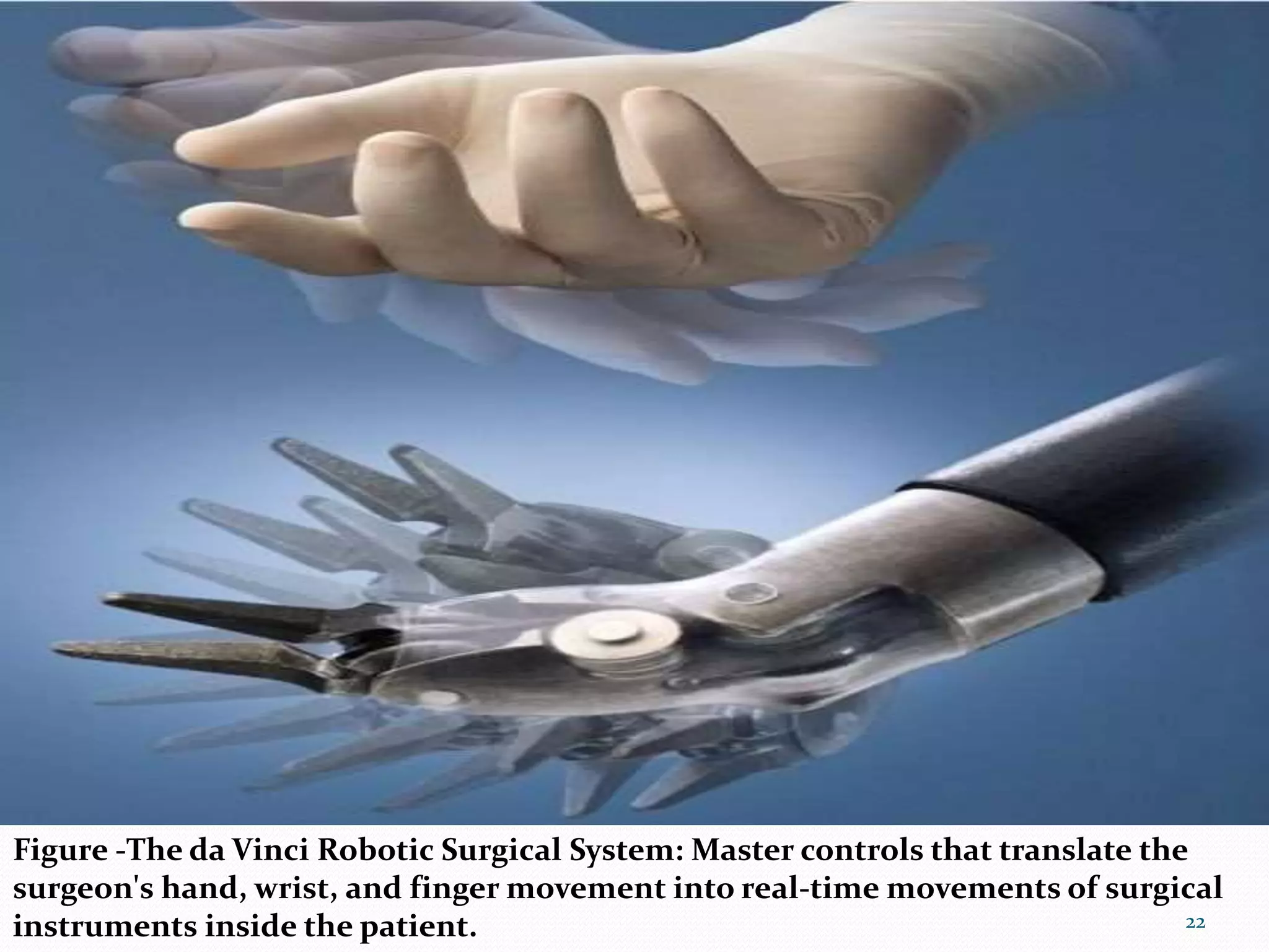 Anesthesia for robotic surgery | PPTX