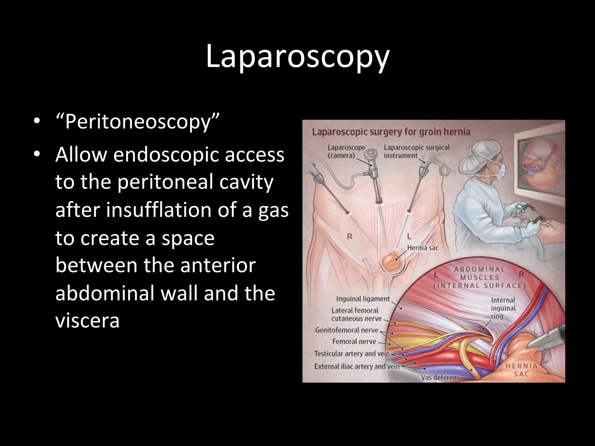 anesthesia for robotic surgery pdf dr vistal.pdf