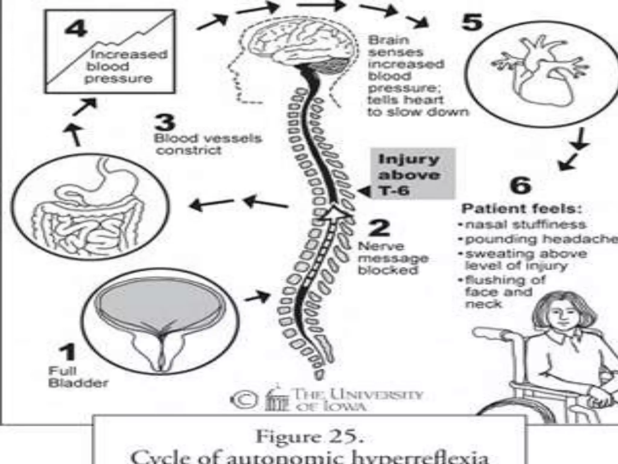 Anesthesia for spinal cord injury and scoliosis030 | PPTX