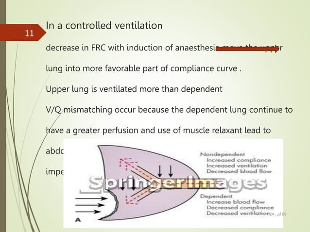 Anesthesia For Thoracic Surgery_071622.pptx