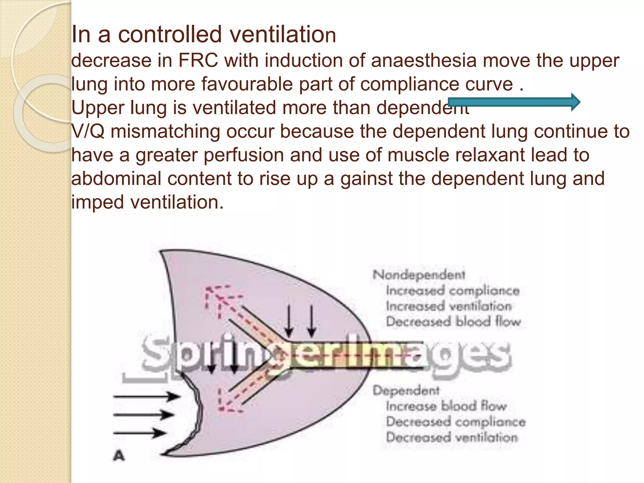 Anesthesia for thoracic surgery (2).pptx
