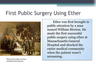 Anesthesia History of Ether | PPT