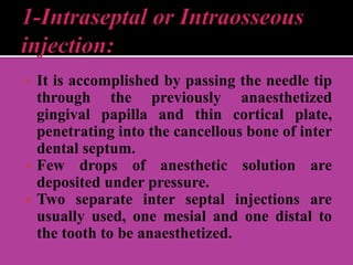 Anesthesia in endodontics | PPTX