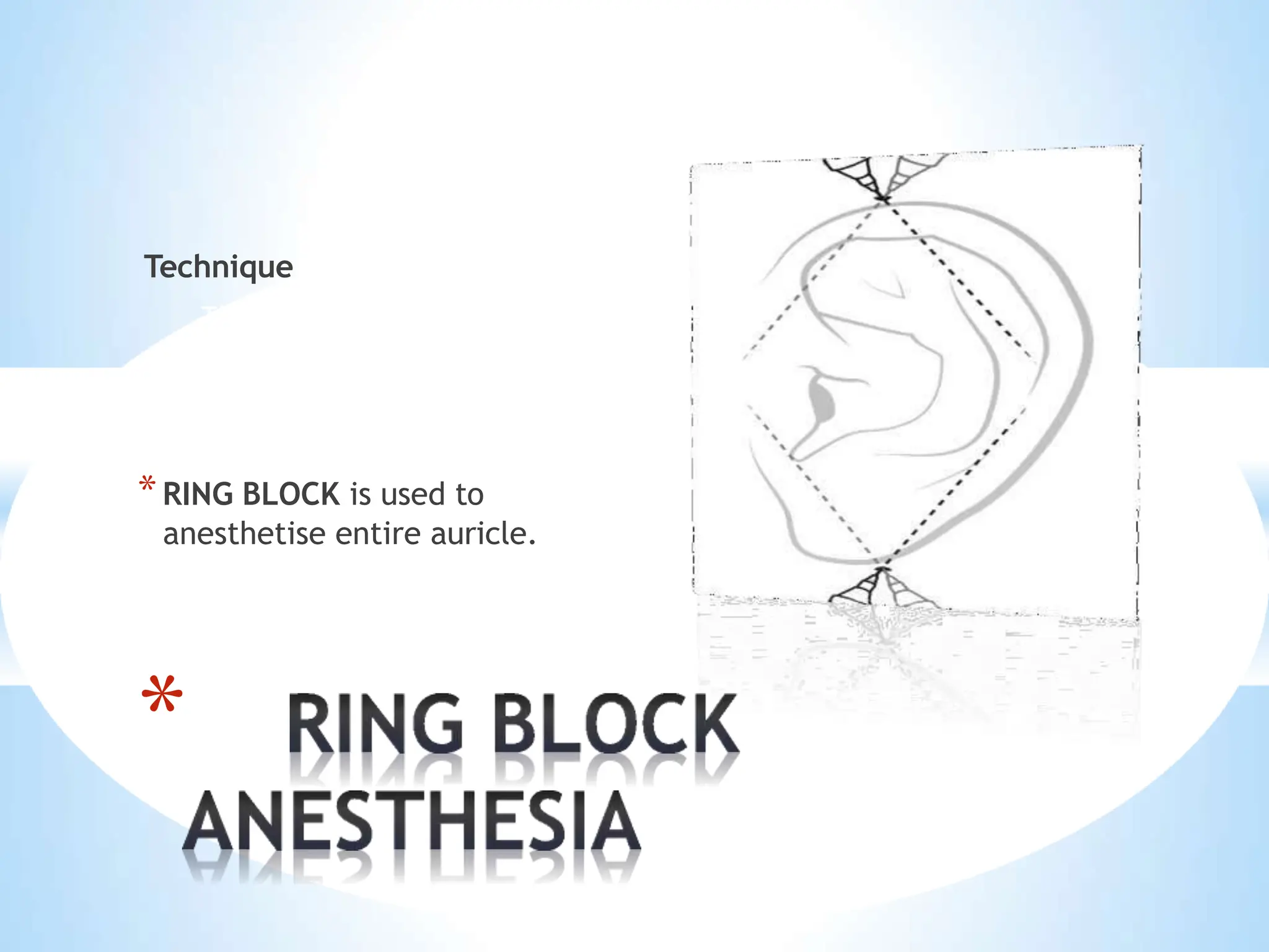 Anesthesia in ENT.pptx