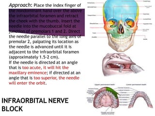 Anesthesia in ENT.pptx