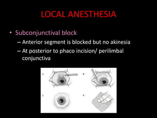 Anesthesia in ophthalmic surgery | PPTX