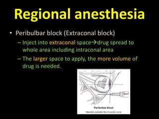 Anesthesia in ophthalmic surgery | PPTX