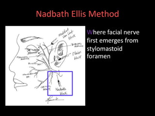 Anesthesia in ophthalmic surgery | PPTX