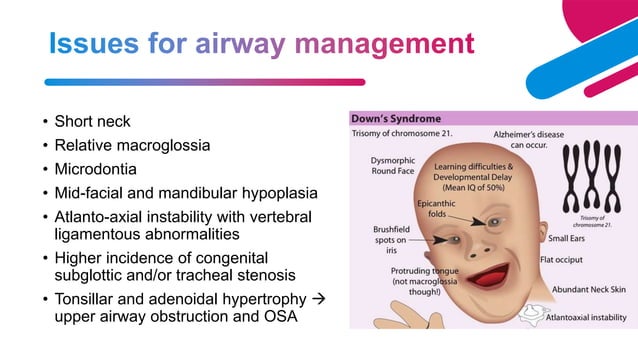 ANESTHESIA IN THE SYNDROMIC CHILD.pptx