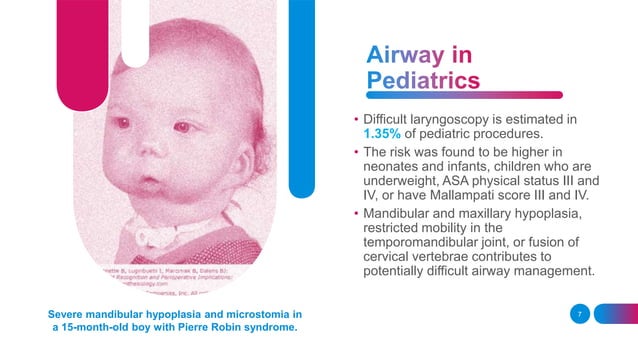 ANESTHESIA IN THE SYNDROMIC CHILD.pptx