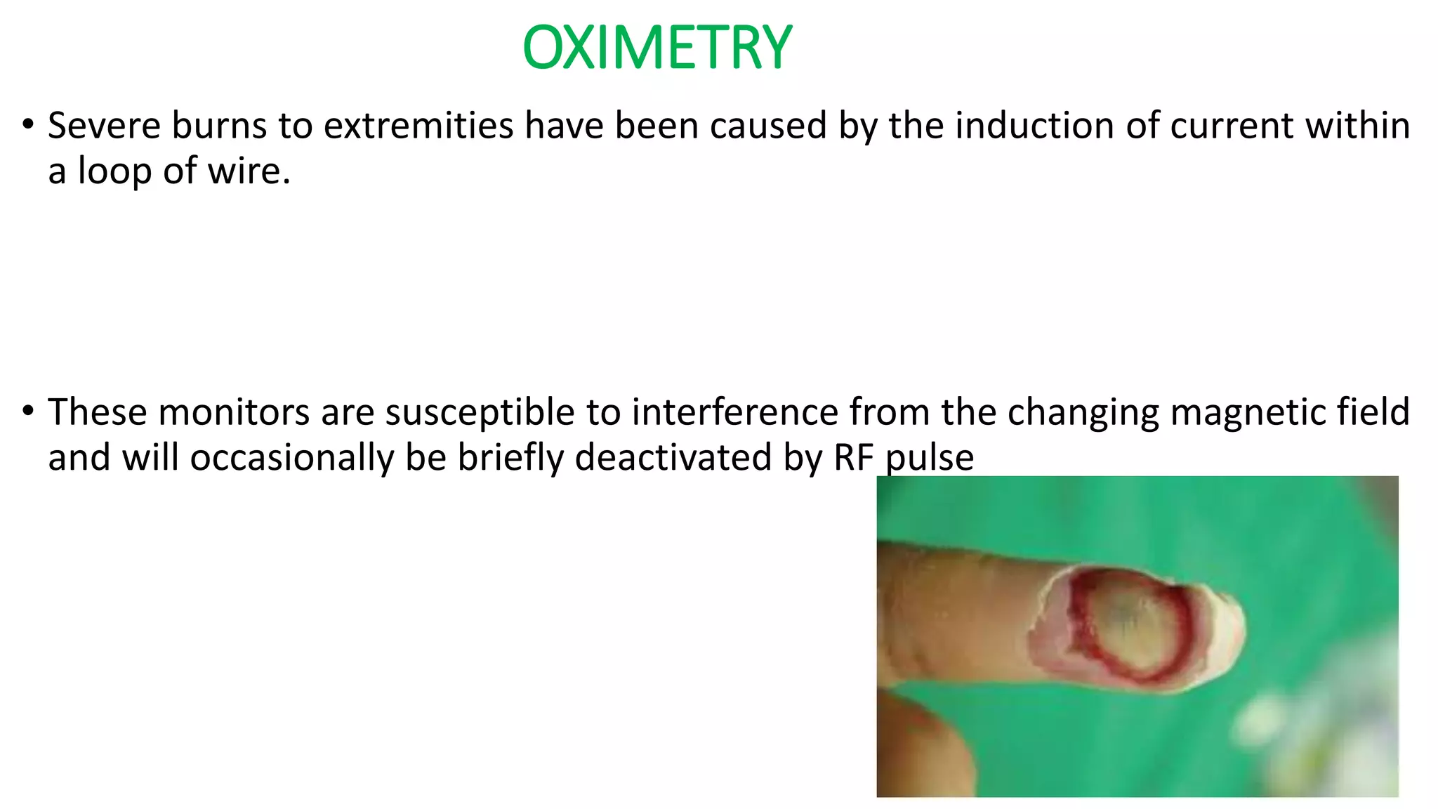 ANESTHESIA for MRI procedures | PPTX