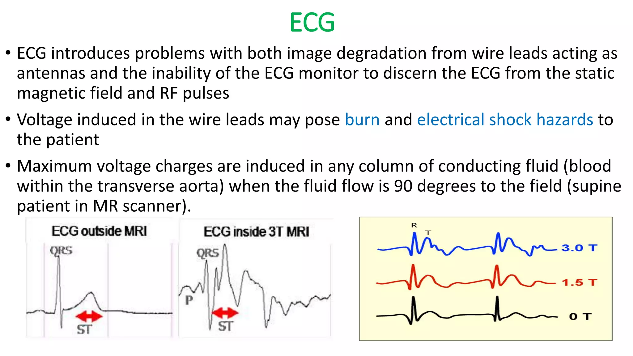 ANESTHESIA for MRI procedures | PPTX