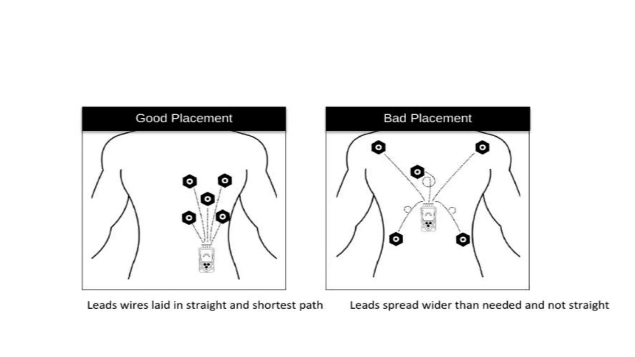 ANESTHESIA for MRI procedures | PPTX