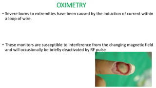 ANESTHESIA for MRI procedures | PPTX