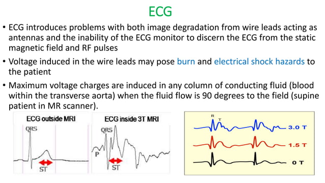 ANESTHESIA for MRI procedures | PPTX