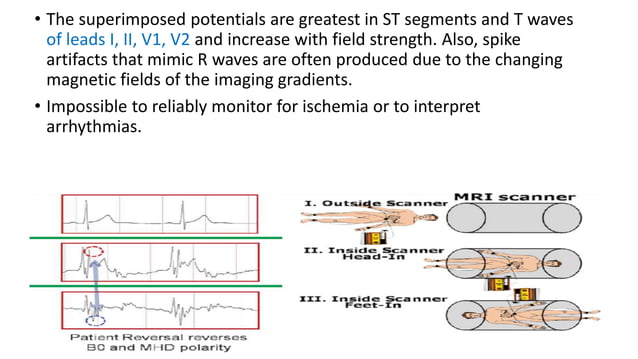 ANESTHESIA for MRI procedures | PPTX