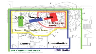ANESTHESIA for MRI procedures | PPTX