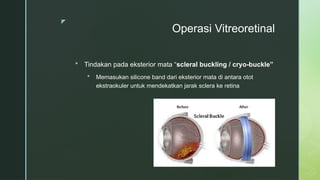 Anesthesia pada Operasi Vitreoretinal.pptx