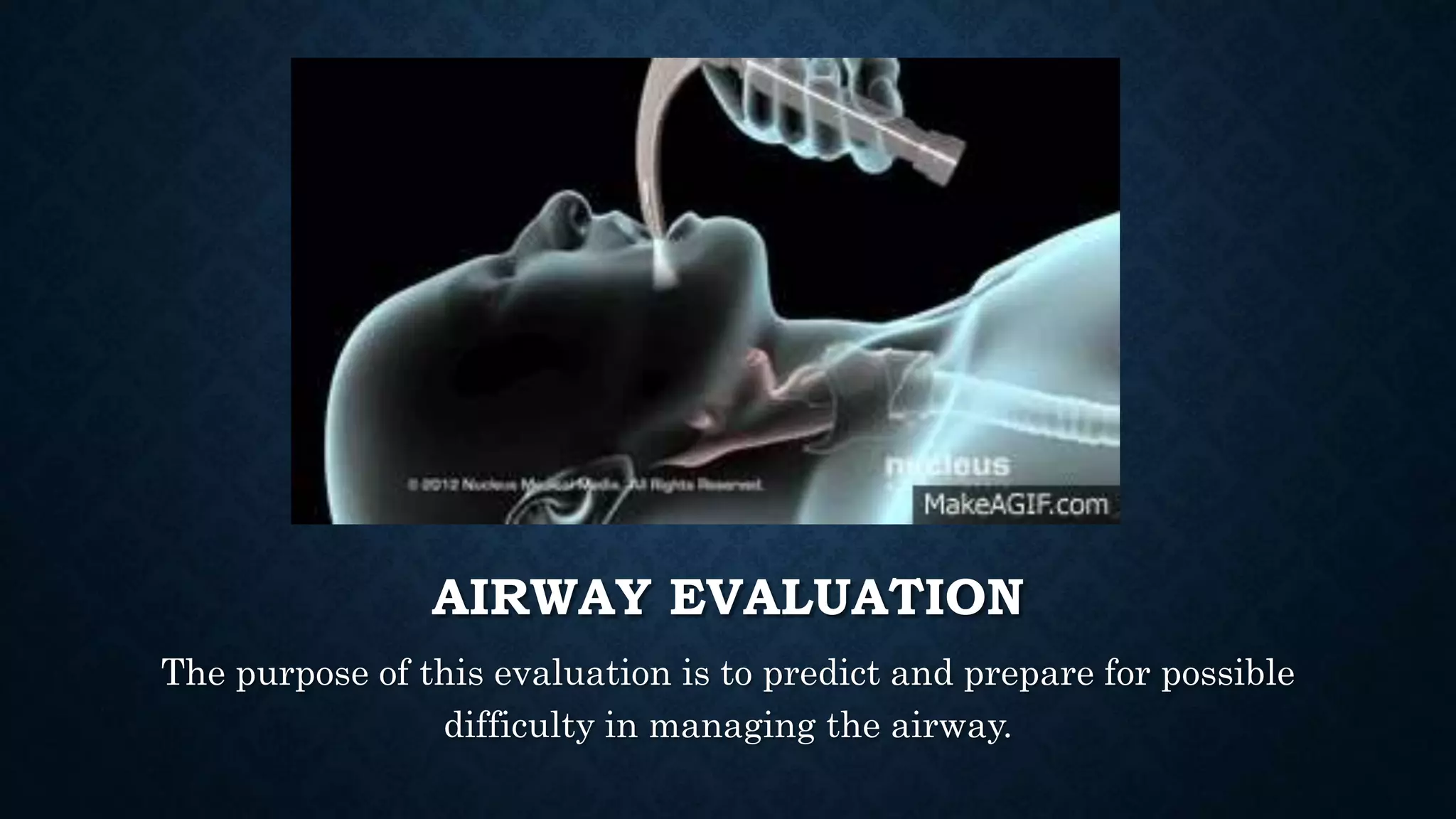 ANESTHESIA PREOPERATIVE EVALUATION.pptx